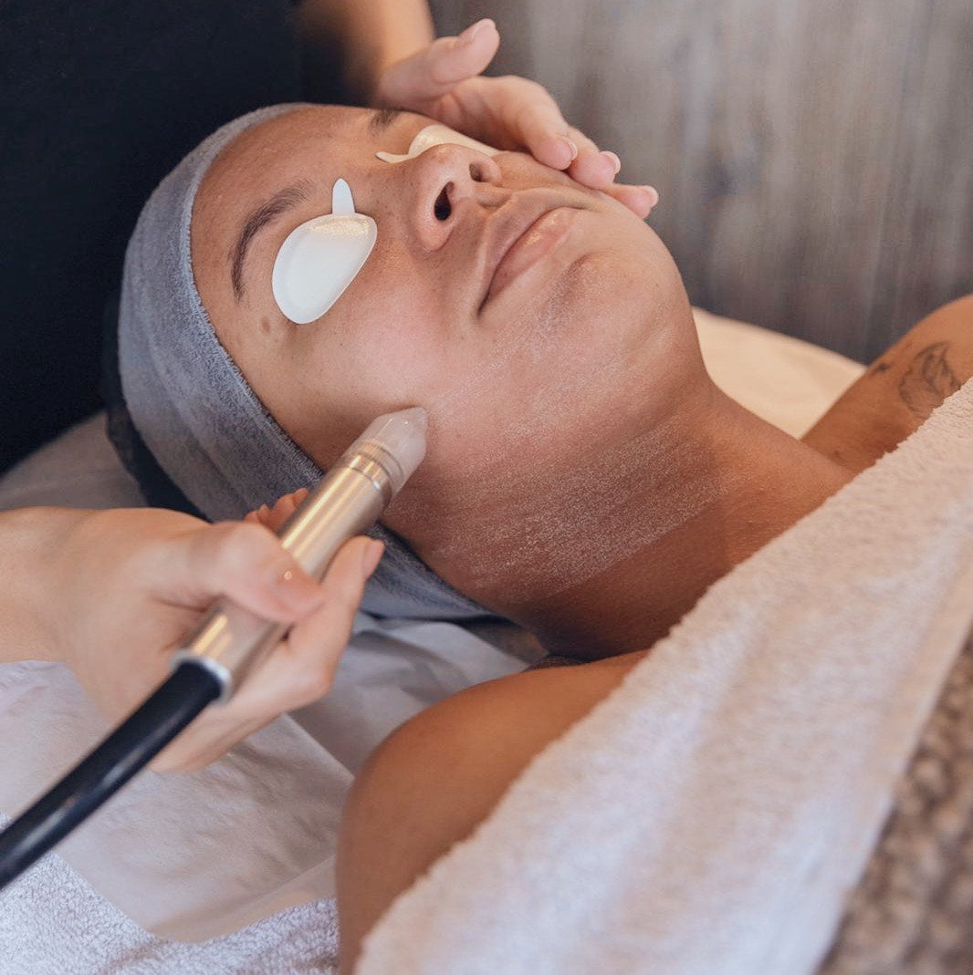 Microdermabrasion treatment – Perfection Elements